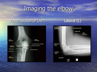 Elbow Anatomy And Examination | PPT