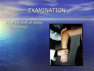 Elbow Anatomy And Examination | PPT