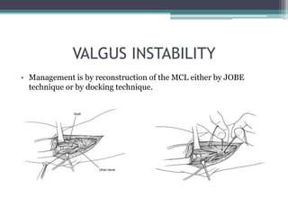 Elbow instability | PPTX