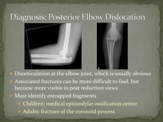 Posterior Elbow Dislocation