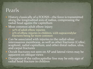 Radial Head Fracture | PPTX