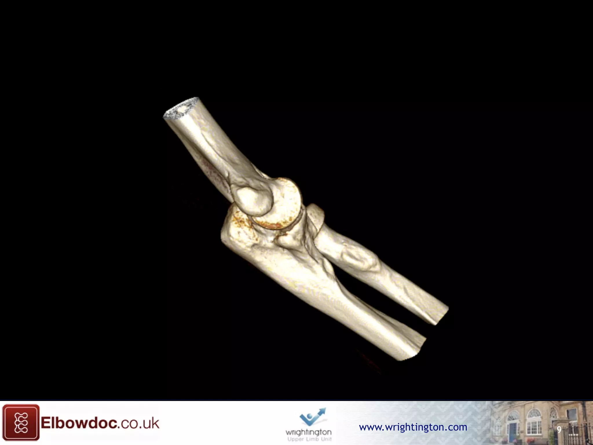 Elbow anatomy and biomechanics | PDF