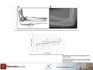 Elbow anatomy and biomechanics | PDF
