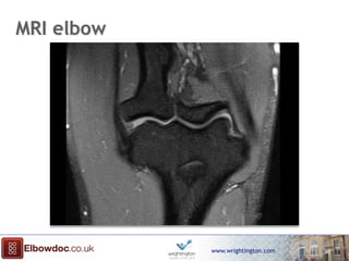 Elbow anatomy and biomechanics | PDF