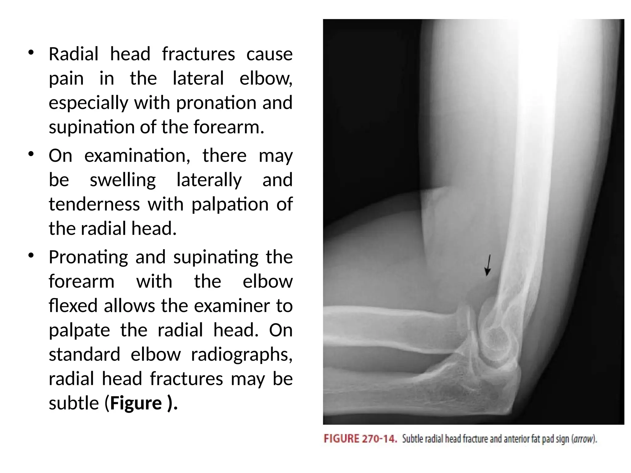 elbow and forearm presentation - DR. KEYUR.pptx