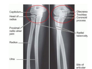 Anatomy of upper limb - elbow and wrist joint.pptx