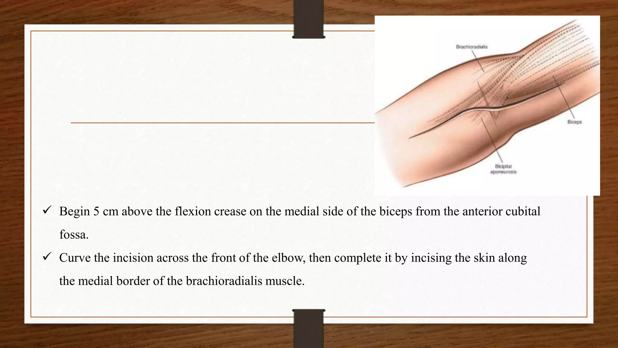 ELBOW Orthopedic Surgical Approaches | PPTX