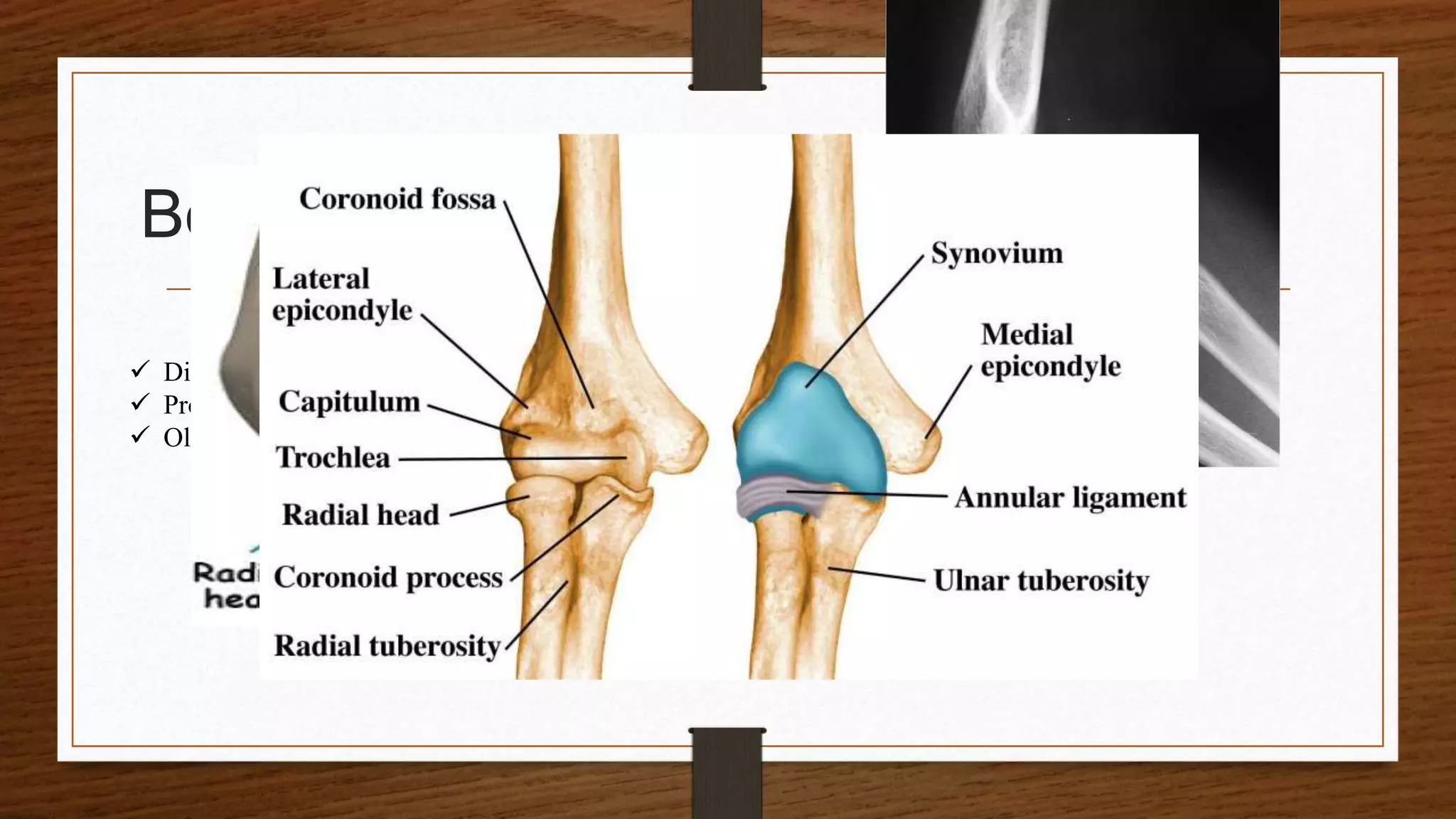 ELBOW Orthopedic Surgical Approaches | PPTX