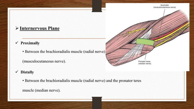 ELBOW Orthopedic Surgical Approaches | PPTX | Death, Injury, or ...