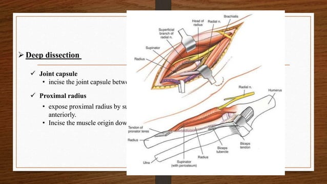 ELBOW Orthopedic Surgical Approaches | PPTX | Death, Injury, or ...