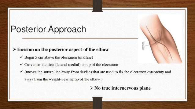 ELBOW Orthopedic Surgical Approaches