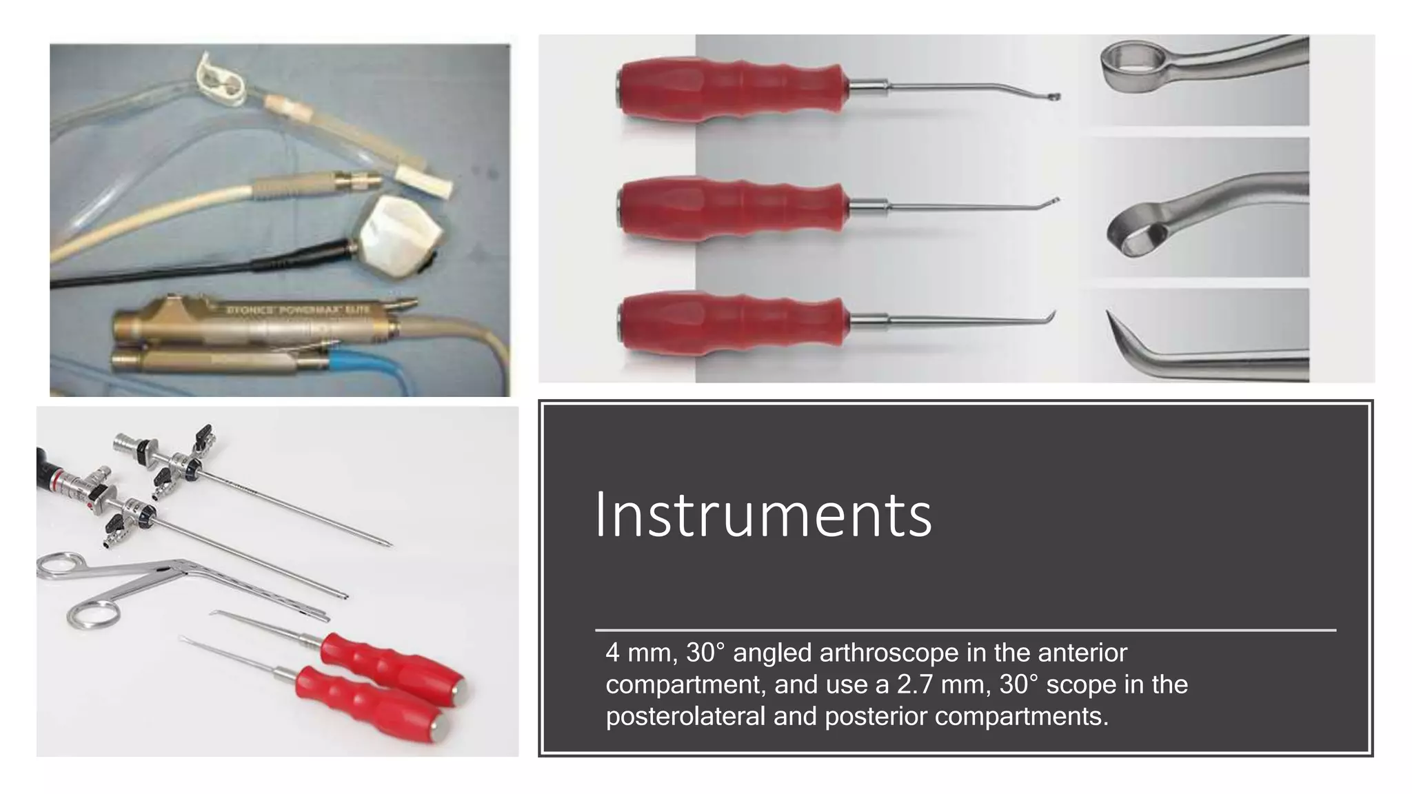 Elbow arthroscopy | PPTX