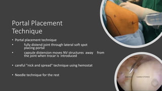 Elbow arthroscopy | PPTX