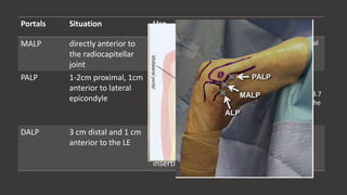Elbow arthroscopy | PPTX