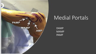 Elbow arthroscopy | PPTX