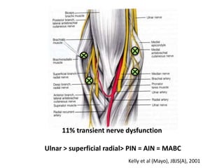 Elbow arthroscopy portals- Ασφαλείς Πύλες Είσόδου στην Αρθροσκόπηση ...
