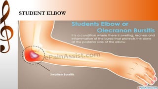 Elbow complex (Biomechanics) | PPTX