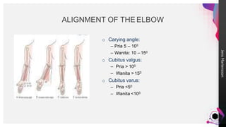 Elbow Complex.pptx