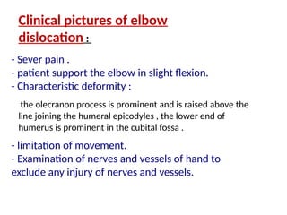 Elbow Dislocation - Anatomy WPS Office.pptx