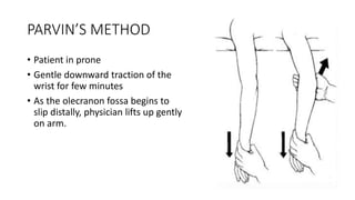 Elbow Dislocation Reduction