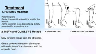 Elbow dislocation treatment options and recovery time | PPT