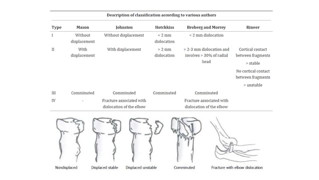 Elbow dislocation with radial head fracture | PPTX