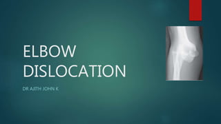 Elbow Dislocation Classification