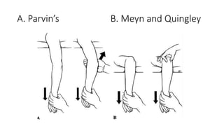 Elbow dislocations | PPTX