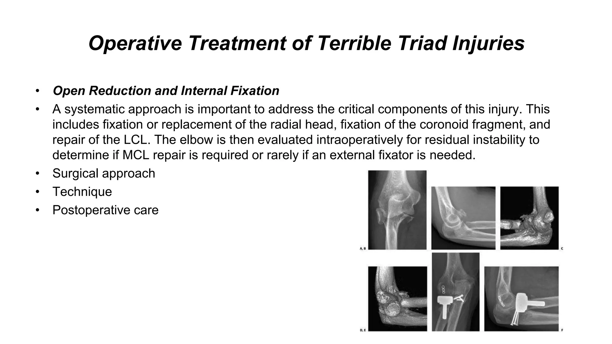 Elbow dislocations and terrible triad | PPTX