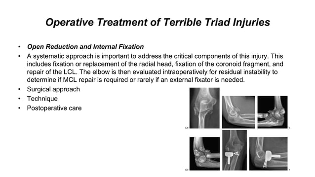 Elbow dislocations and terrible triad | PPTX | First Aid | Injuries