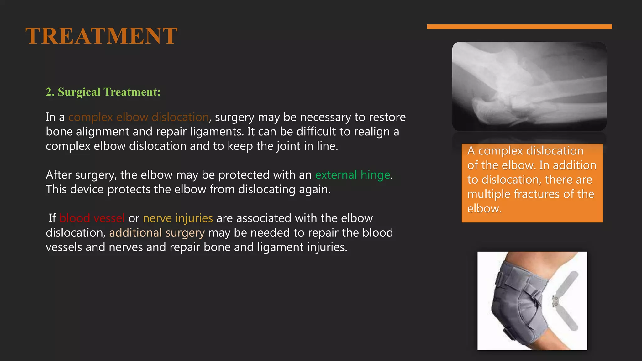 Elbow dislocation and subluxation | PPTX