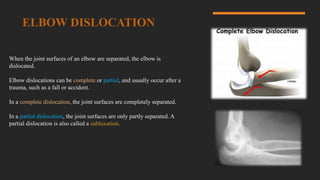 Elbow dislocation and subluxation | PPTX