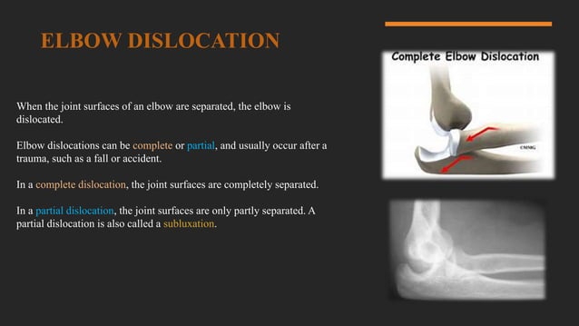 Elbow dislocation and subluxation | PPTX | First Aid | Injuries