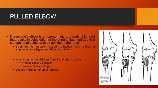 Elbow disorders 5th stage lecture (dr.farouk) | PPTX