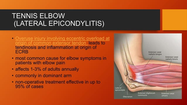 Elbow disorders 5th stage lecture (dr.farouk) | PPTX
