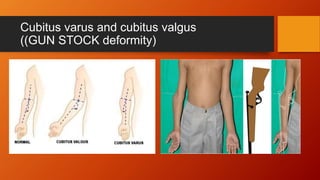 Elbow disorders 5th stage lecture (dr.farouk) | PPTX