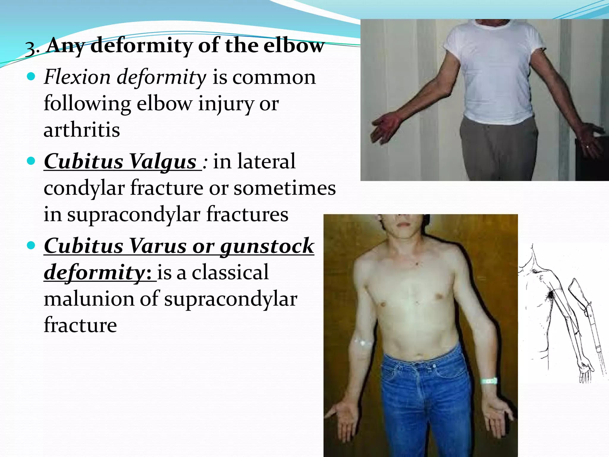 Elbow examination | PDF