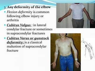 Elbow examination | PPT