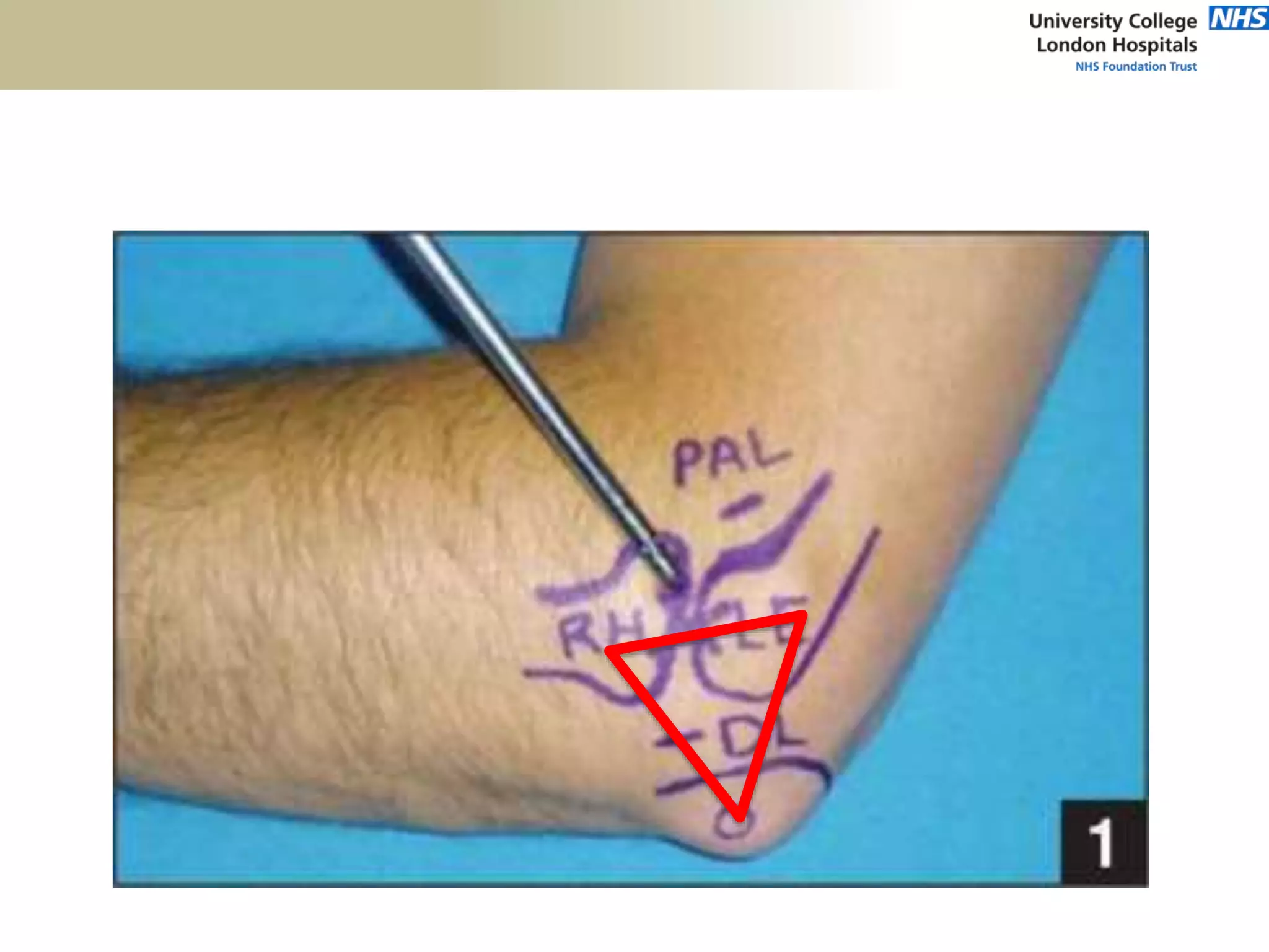 Elbow examination | PPTX