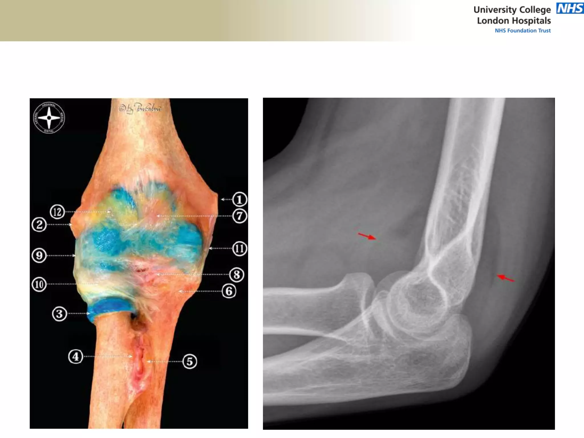 Elbow examination | PPTX