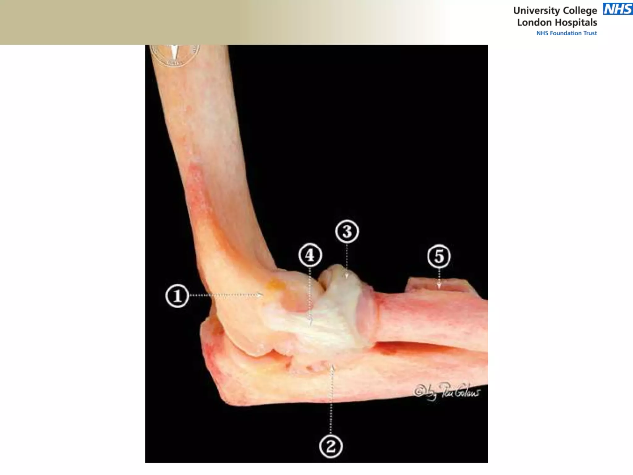Elbow examination | PPTX