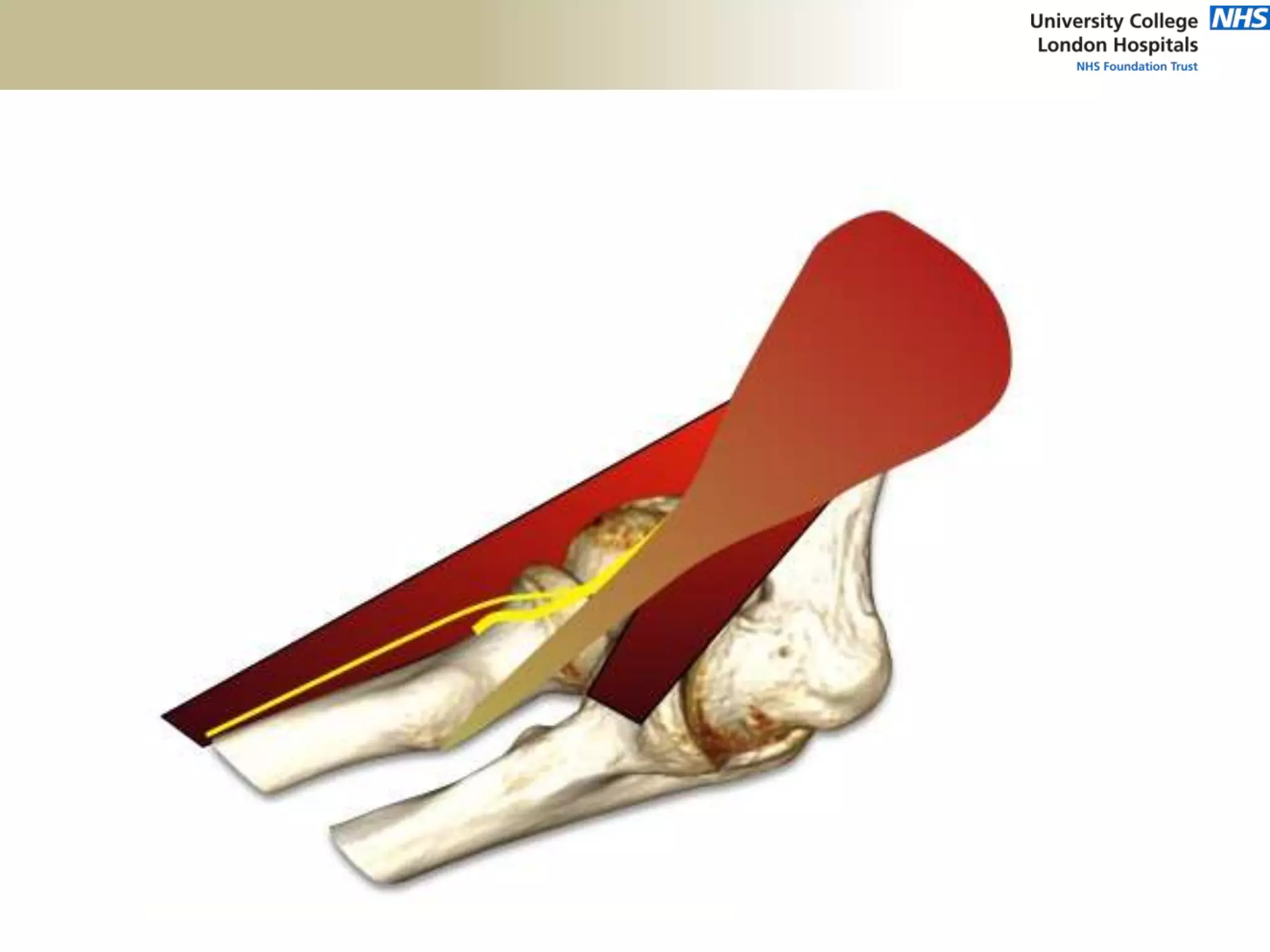 Elbow examination | PPTX