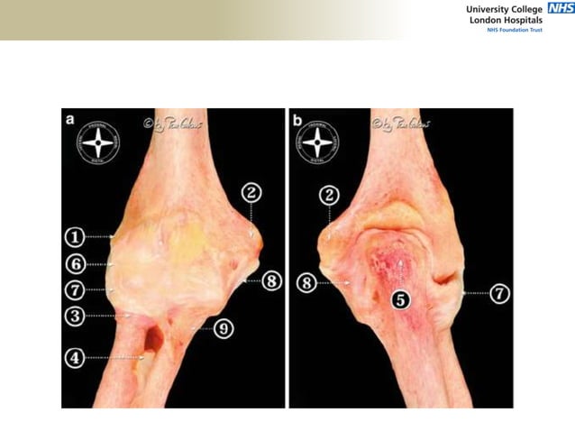 Elbow examination | PPTX