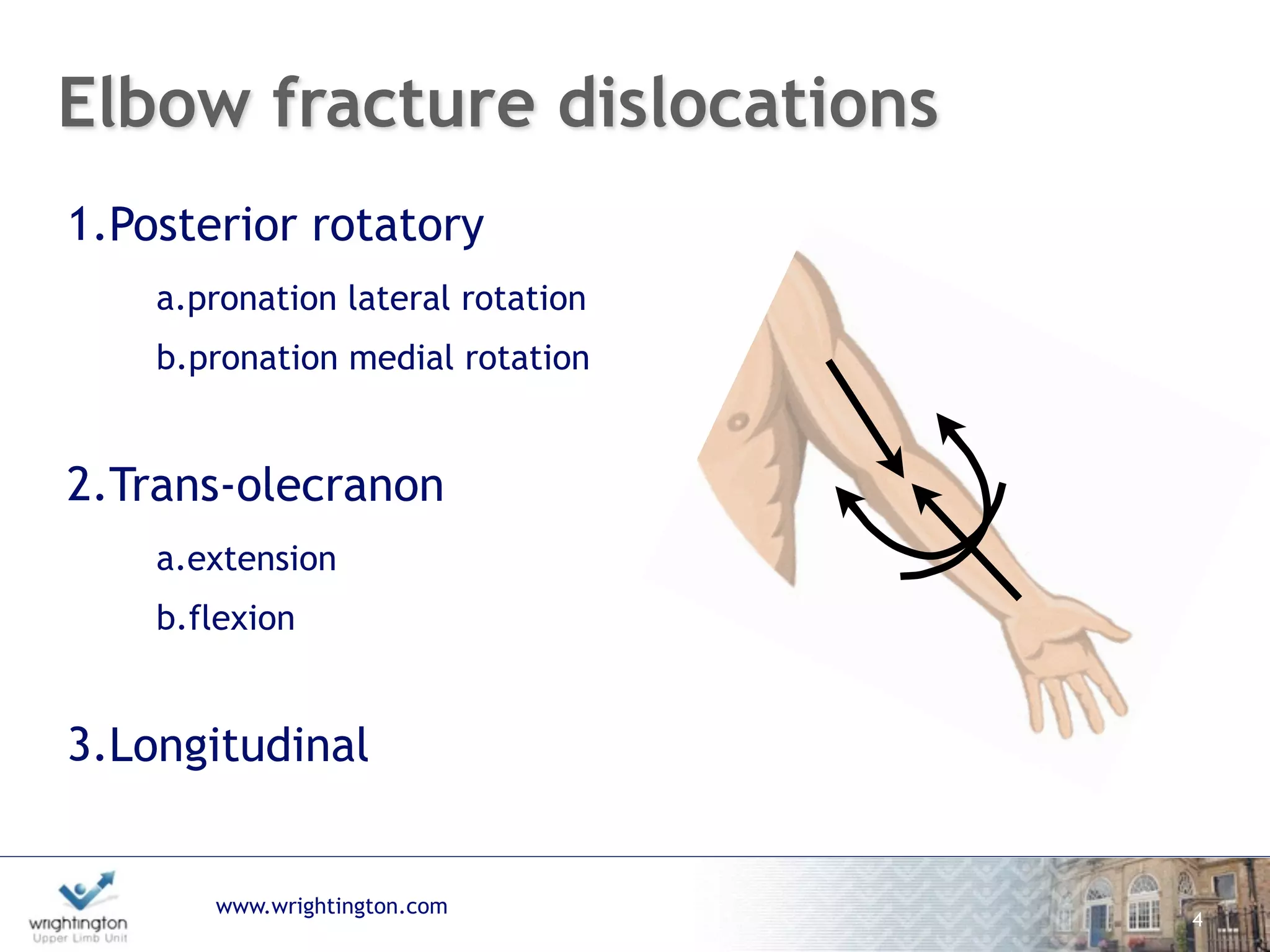 Elbow fracture dislocations adam watts | PDF