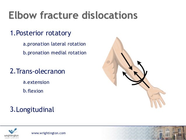 Elbow fracture dislocations adam watts