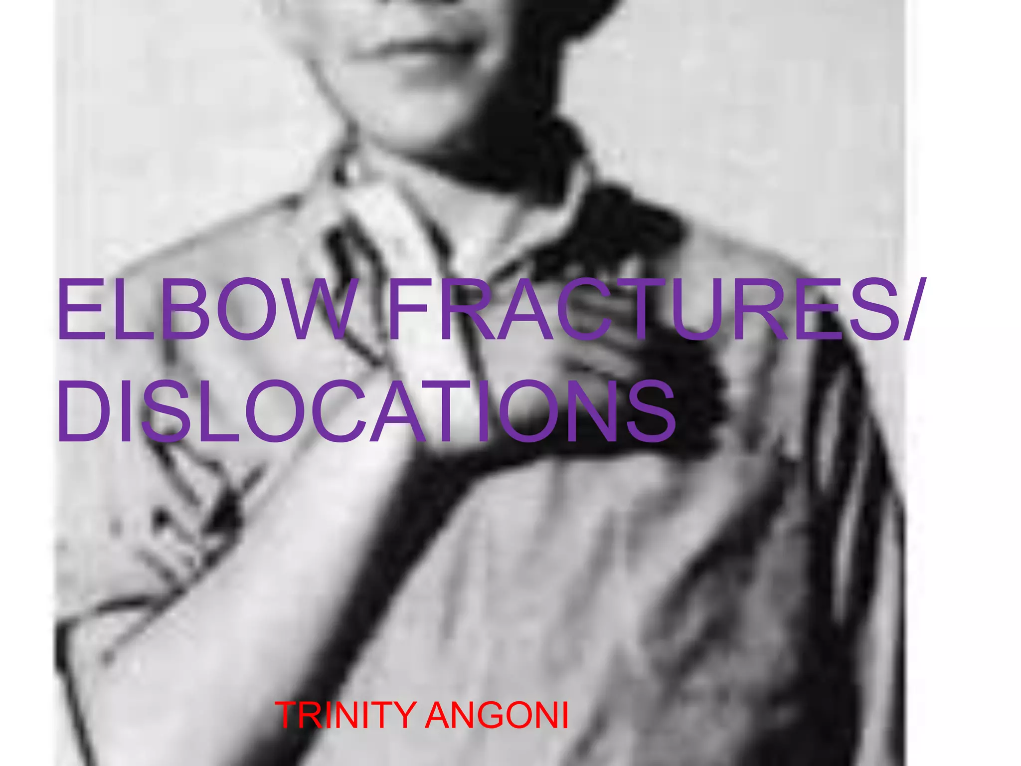 Elbow fractures and dislocations | PPTX