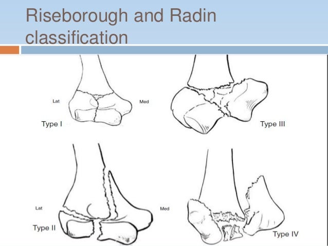 Elbow fractures and dislocations