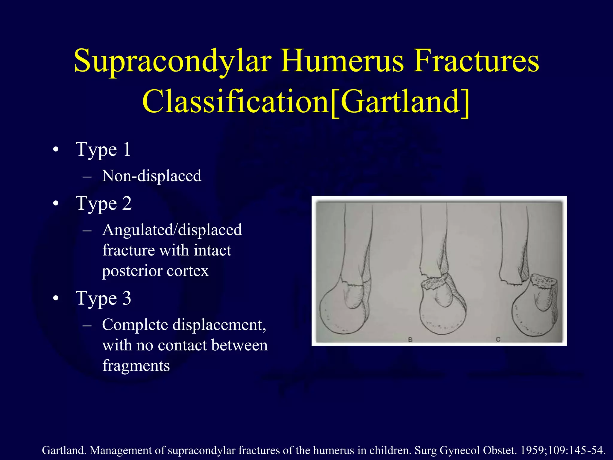 ELBOW_FRACTURE& Supracondylar fracture .ppt