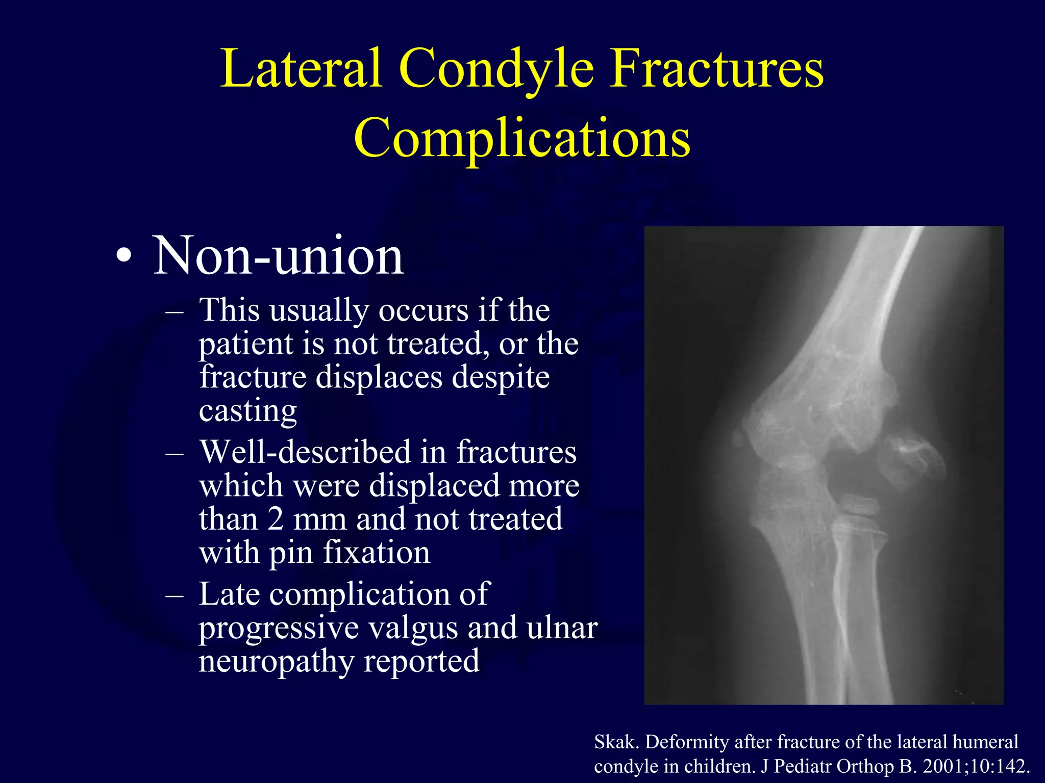 ELBOW_FRACTURE& Supracondylar fracture .ppt
