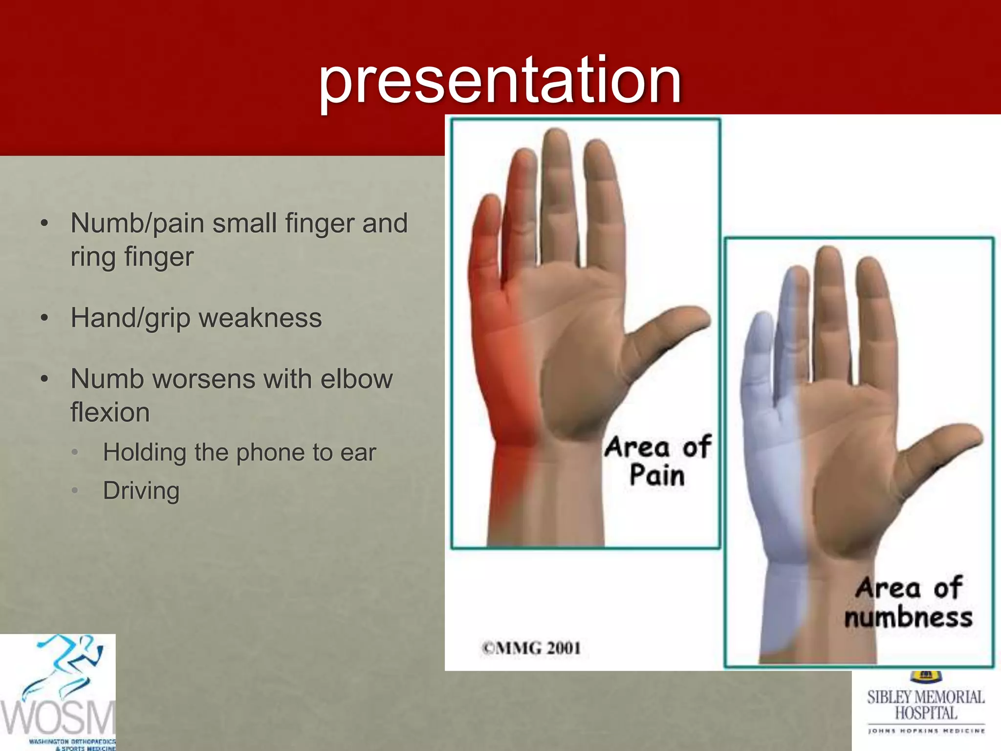Elbow Injuries | PPTX